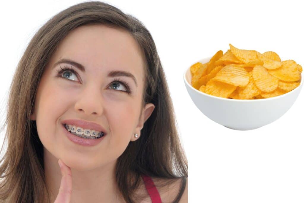 Can You Eat Chips While Wearing Braces?